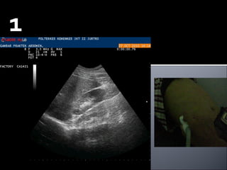Pemeriksaan USG | PPT