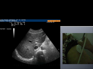 Pemeriksaan USG | PPT