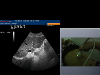 Pemeriksaan USG | PPT