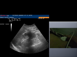 Pemeriksaan USG | PPT
