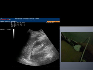 Pemeriksaan USG | PPT