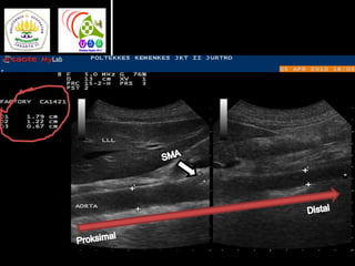 Pemeriksaan USG | PPT