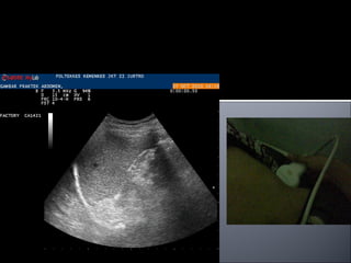 Pemeriksaan USG | PPT