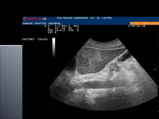 Pemeriksaan USG | PPT