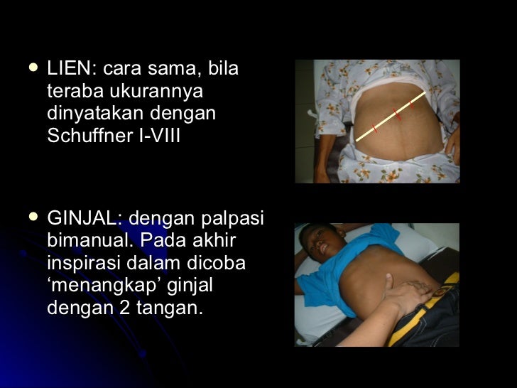 Pem fisik 20 februari