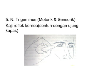 Pemfis neurologi@dons | PPT