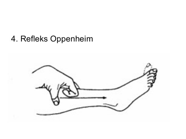 Pemfis neurologi@dons