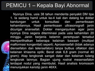 Anensefali (embriologi) | PPTX