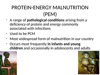 PEM LECTURE- CHAPTER NUTRITION &HEALTH IN COMMUNITY MEDICINE | PPT