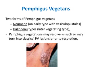 Pemphigus Vegetans