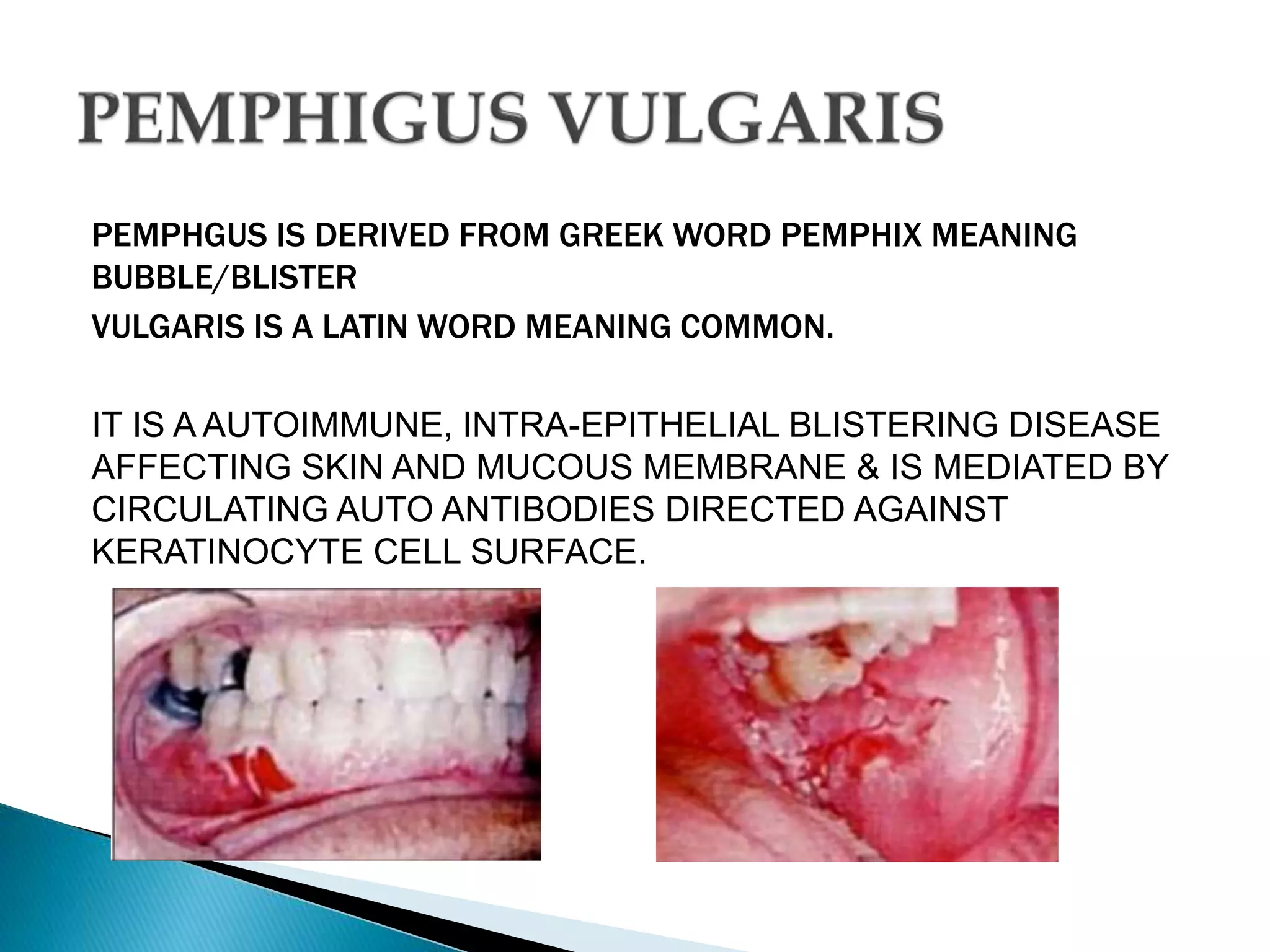 Pemphigus and Pemphigoid | PPTX