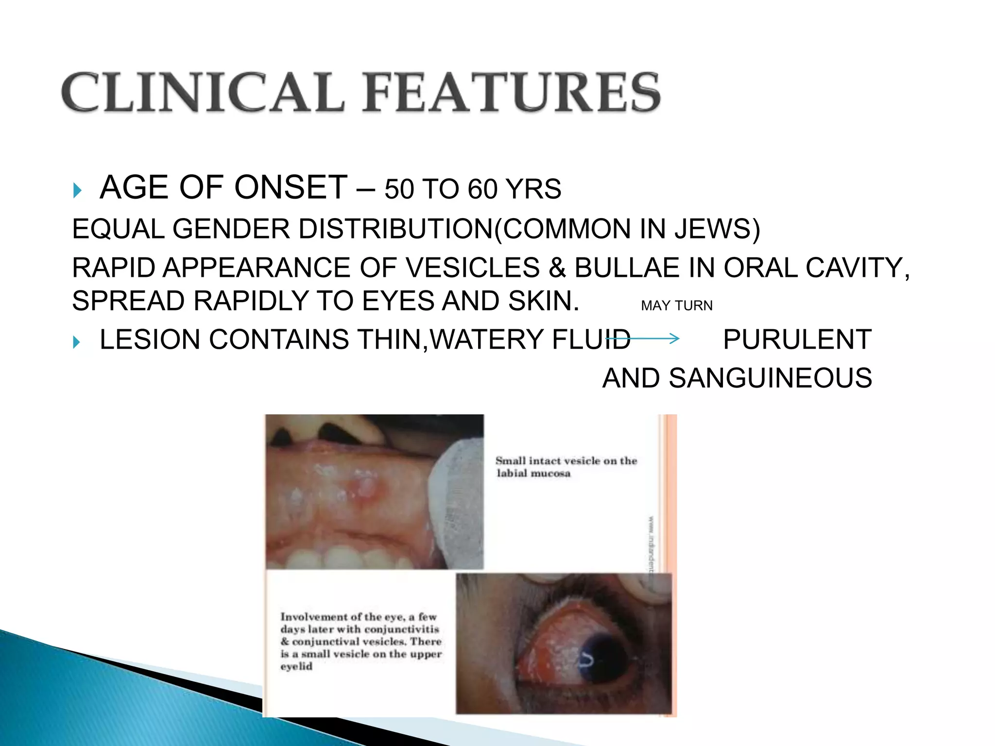 Pemphigus and Pemphigoid | PPTX