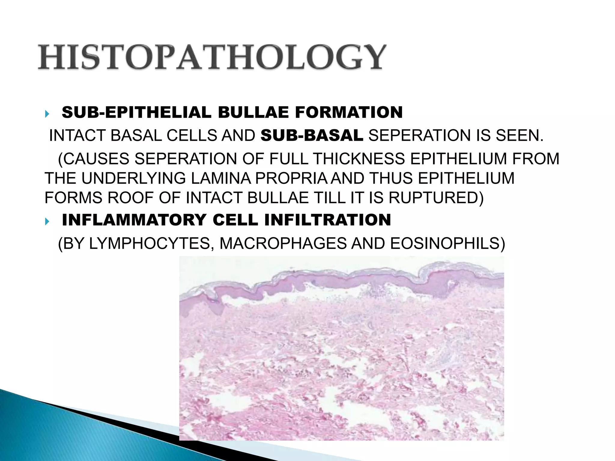 Pemphigus and Pemphigoid | PPTX