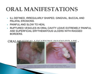 Pemphigus and Pemphigoid | PPTX