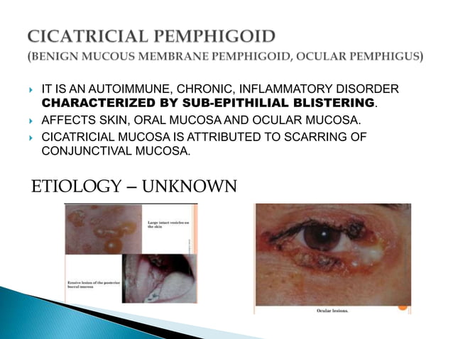 Pemphigus and Pemphigoid | PPTX | Skin and Dermatology | Diseases and ...