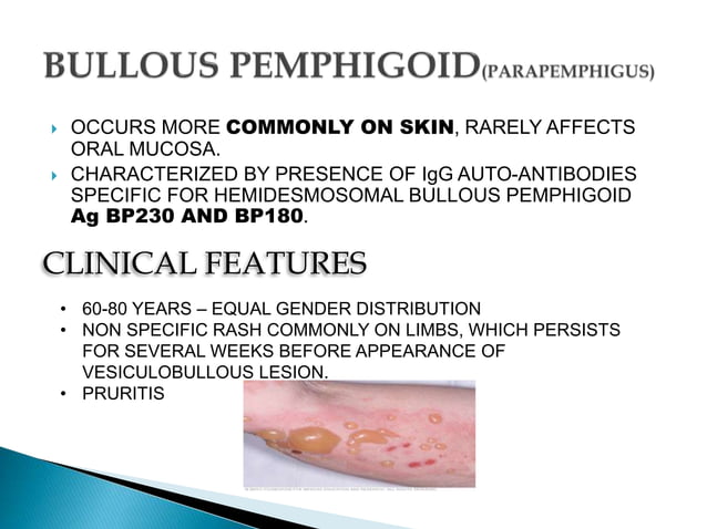 Pemphigus and Pemphigoid | PPTX | Skin and Dermatology | Diseases and ...