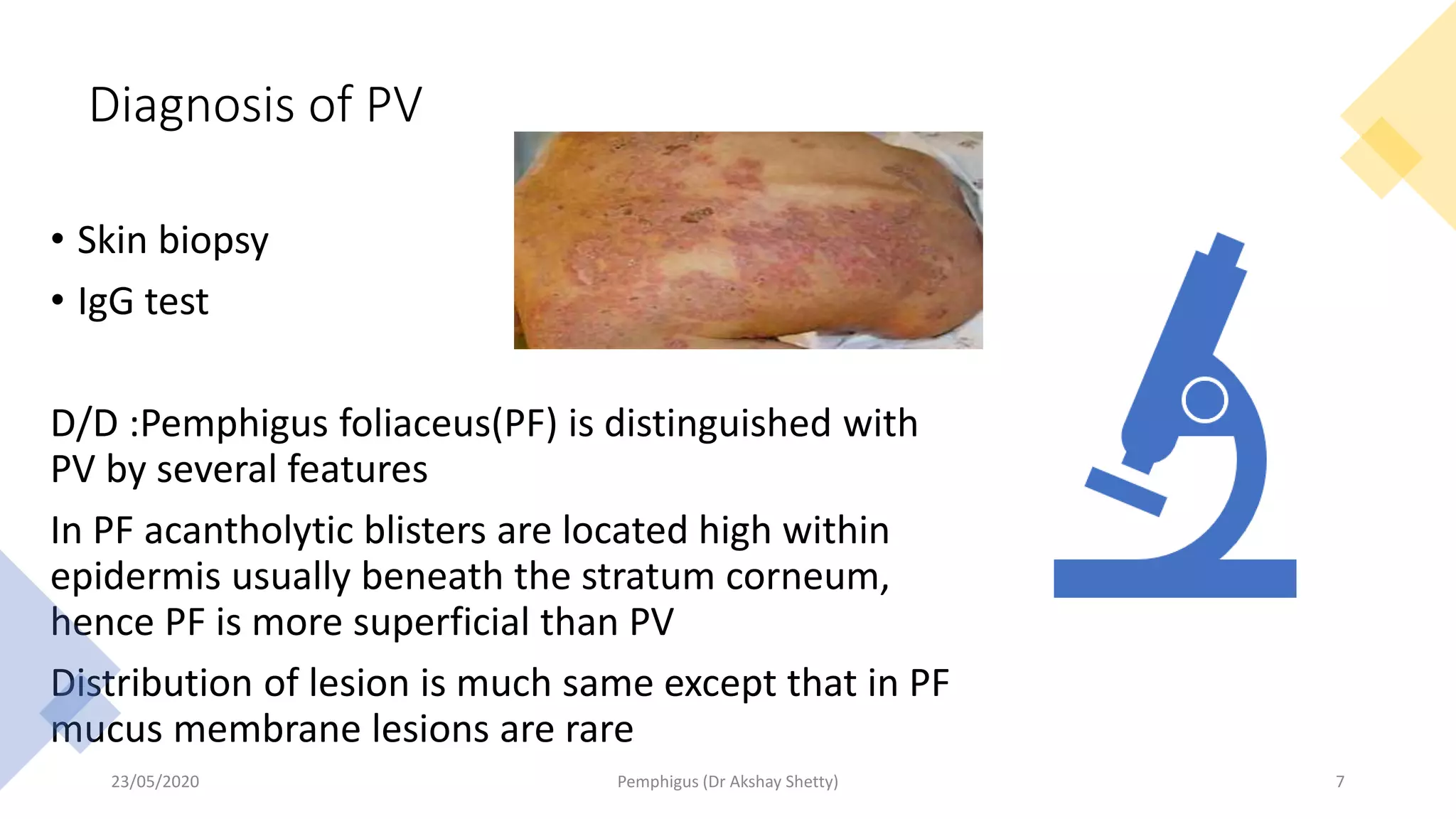 Pemphigus | PPTX