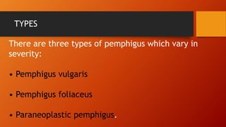 PEMPHIGUS.pptx Pemphigus is a blistering autoimmune disease that ...