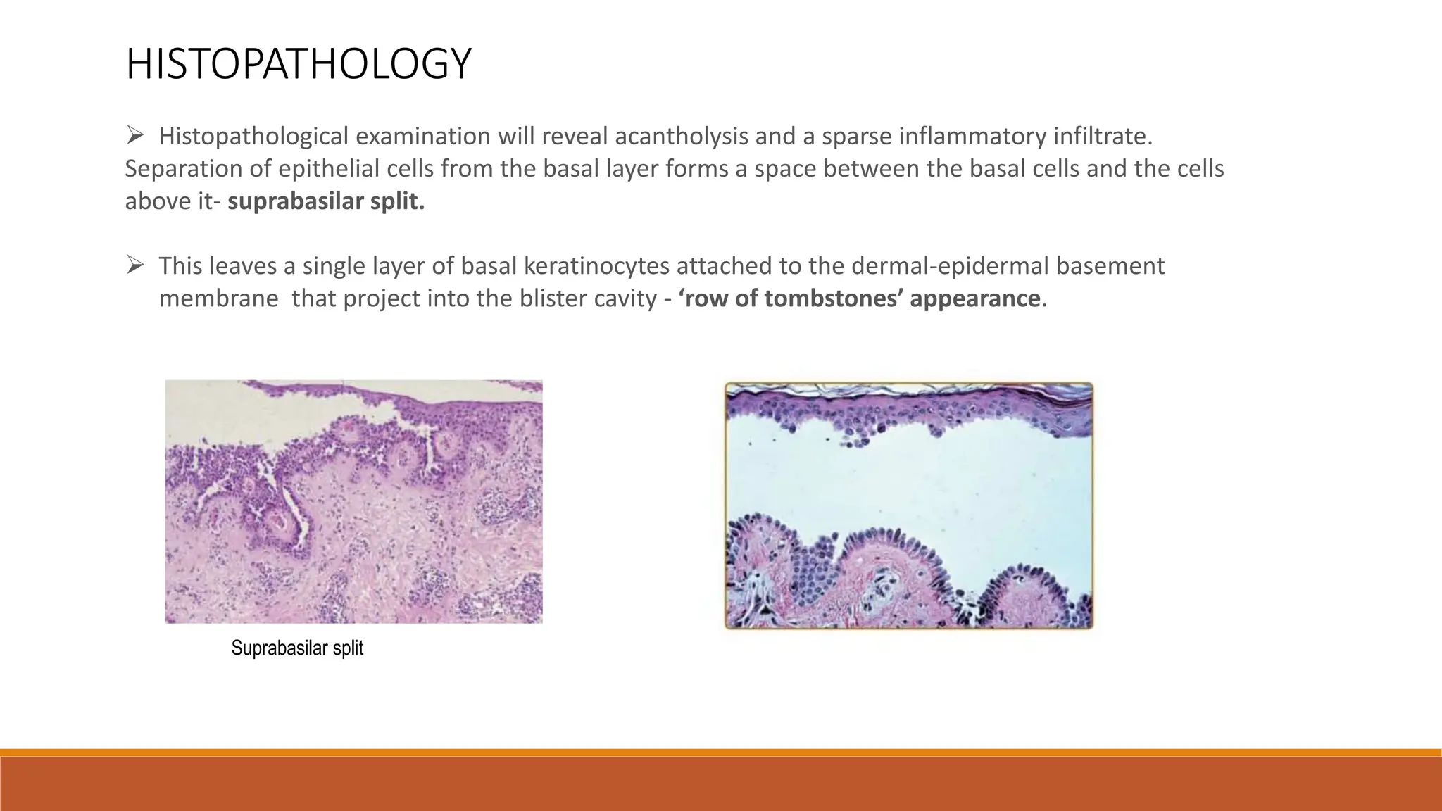PEMPHIGUS, skin and mucous membrane disease | PPT