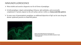 PEMPHIGUS, skin and mucous membrane disease | PPTX