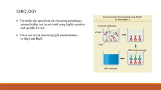 PEMPHIGUS, skin and mucous membrane disease | PPTX