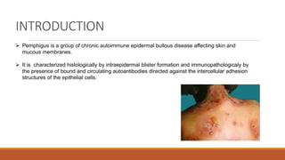 PEMPHIGUS, skin and mucous membrane disease | PPTX