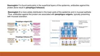 PEMPHIGUS, skin and mucous membrane disease | PPTX
