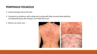 PEMPHIGUS, skin and mucous membrane disease | PPTX