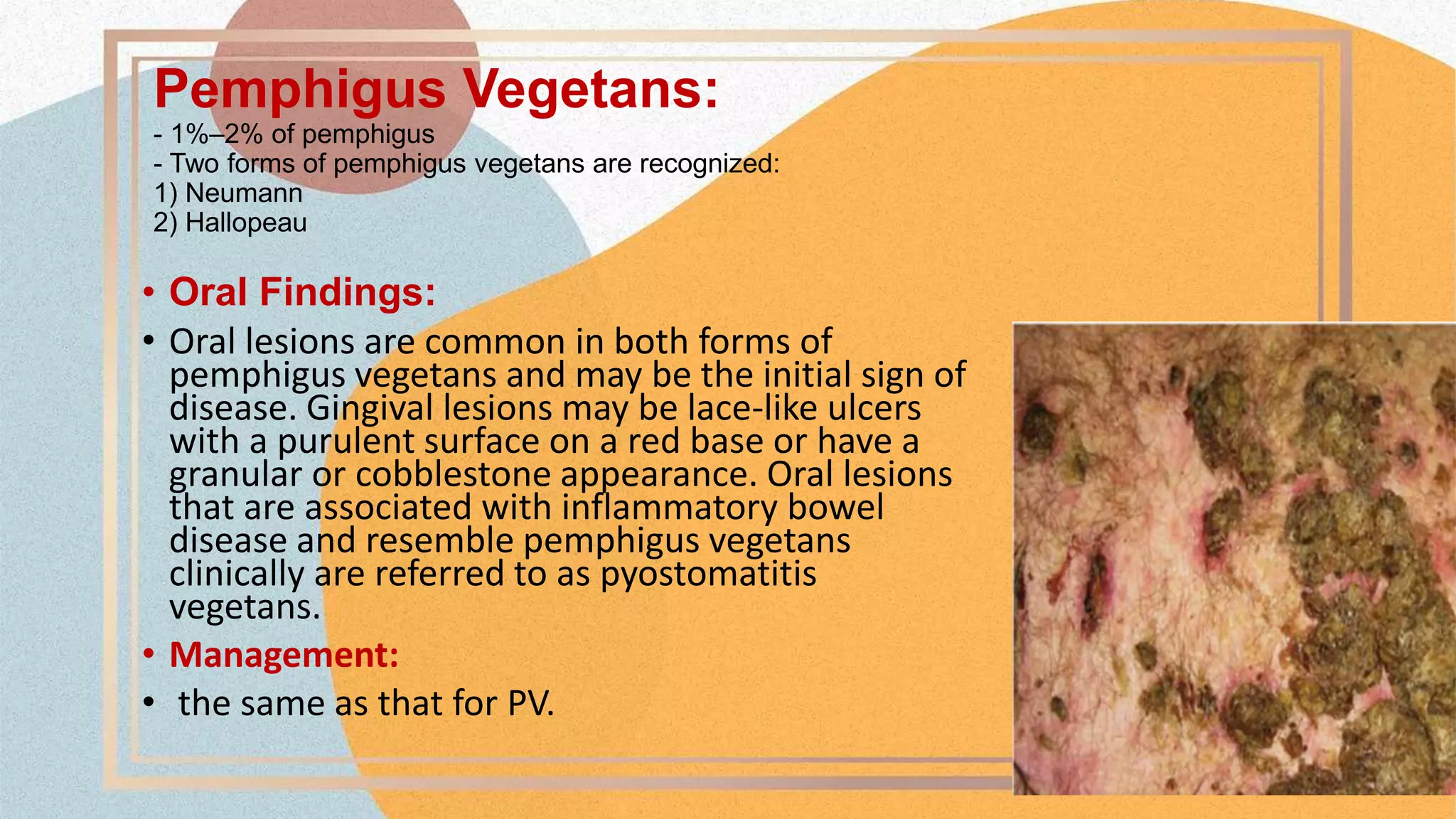 Pemphigus pemphigoid | PPTX
