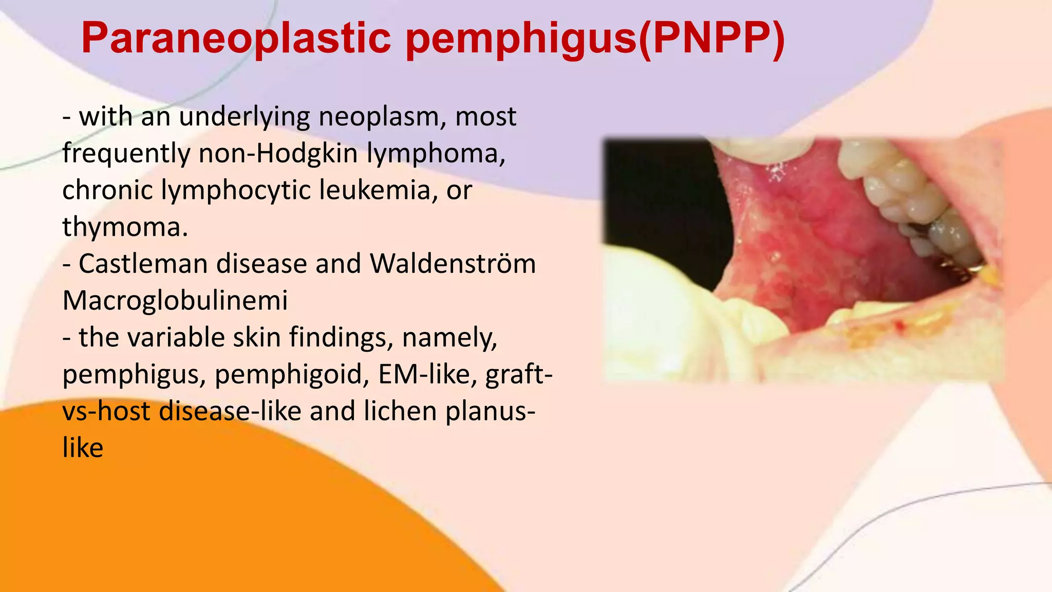 Pemphigus pemphigoid | PPTX