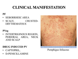 Pemphigus (Bullous Disease) | PPTX