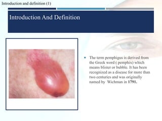 Pemphigus | PPTX