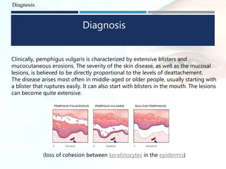 Pemphigus | PPTX