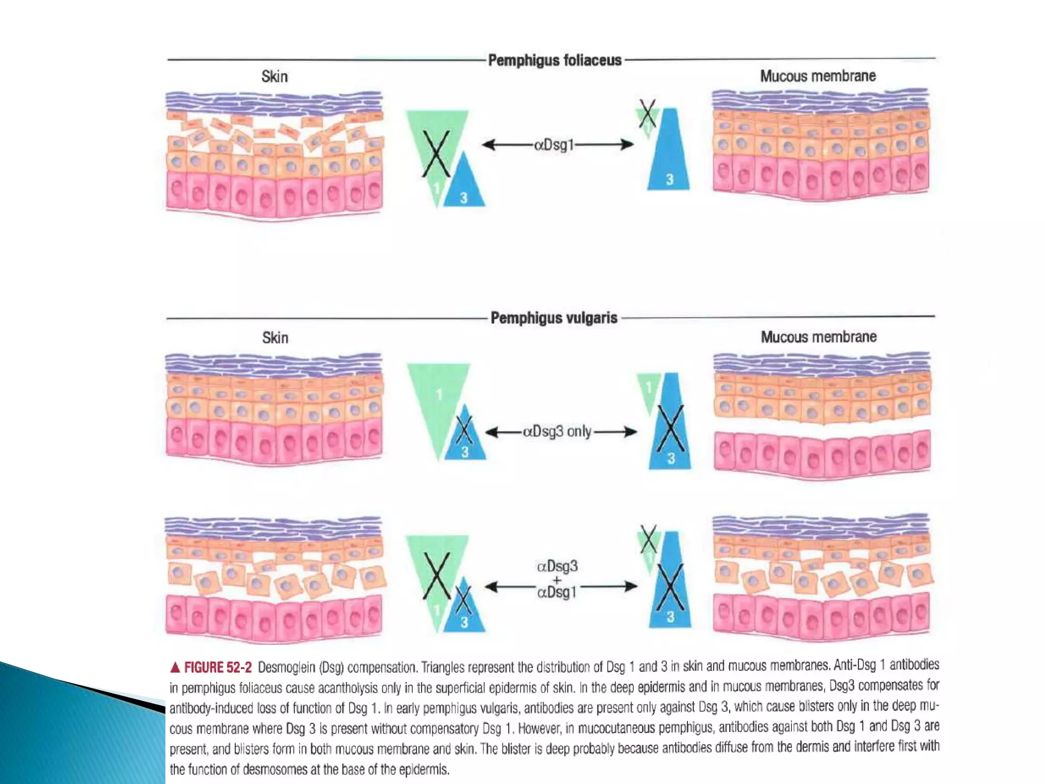 Pemphigus group of disorders | PPTX