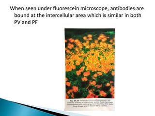 Pemphigus group of disorders | PPTX