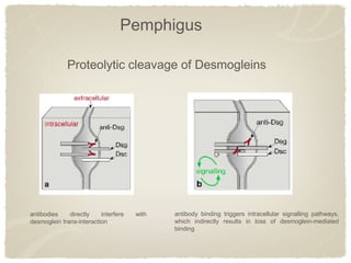 Pemphigus n candidiasis | PPT