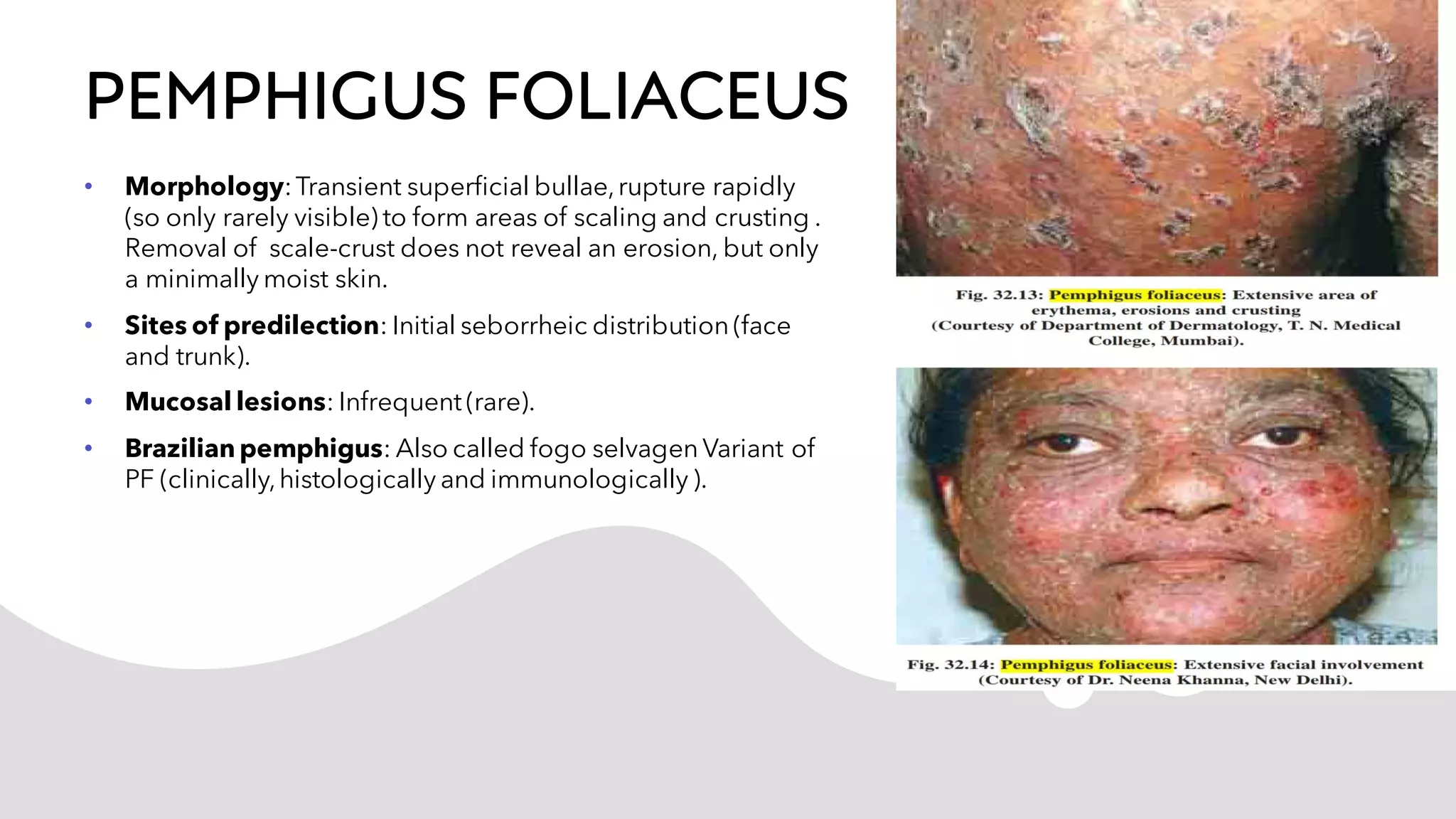 PEMPHIGUS | PDF