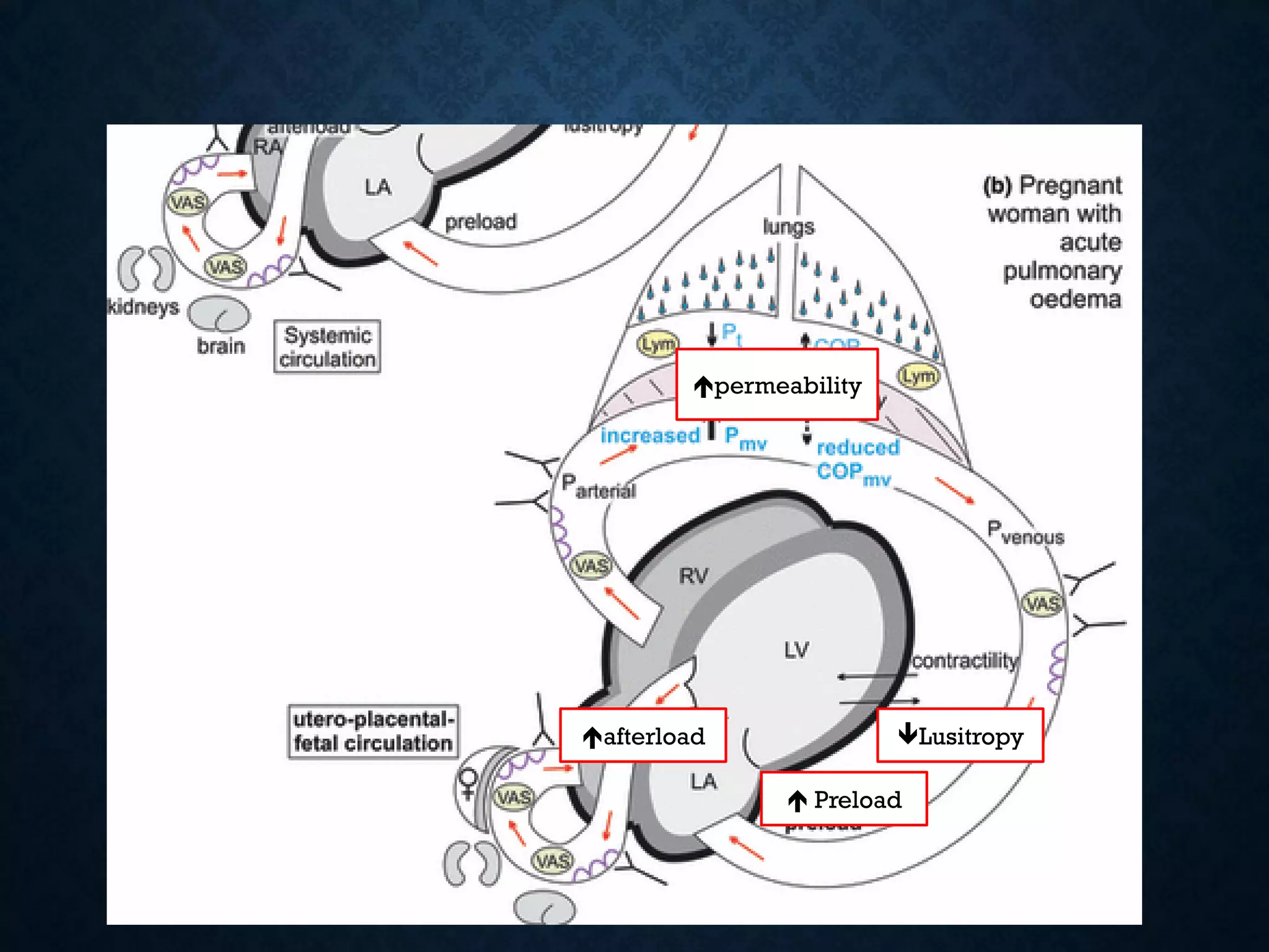 Penanganan-Edema-Paru-Pada-PreEklampsia.pdf