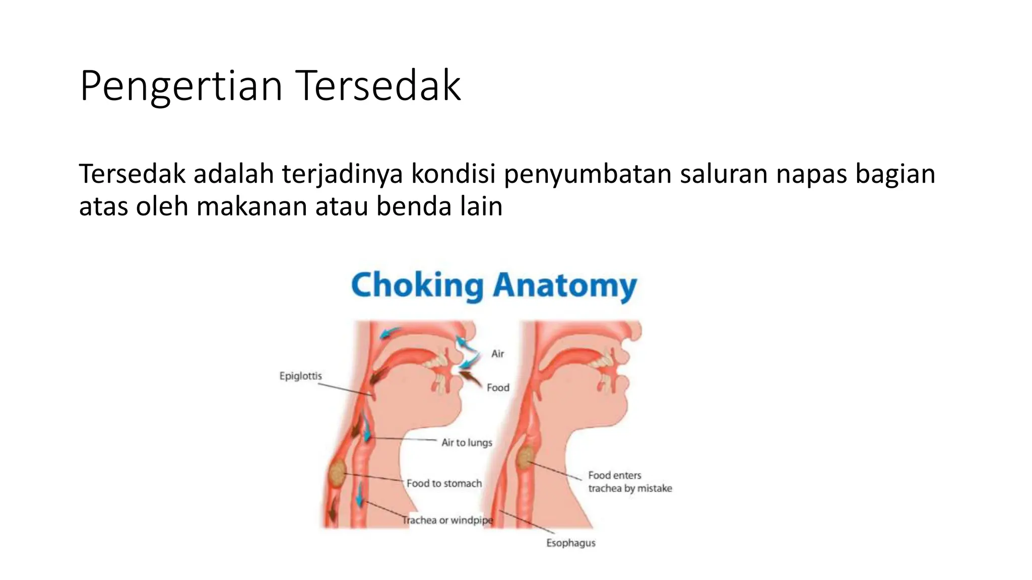 PENANGANAN AWAL TERSEDAK pasien mau ma.pptx