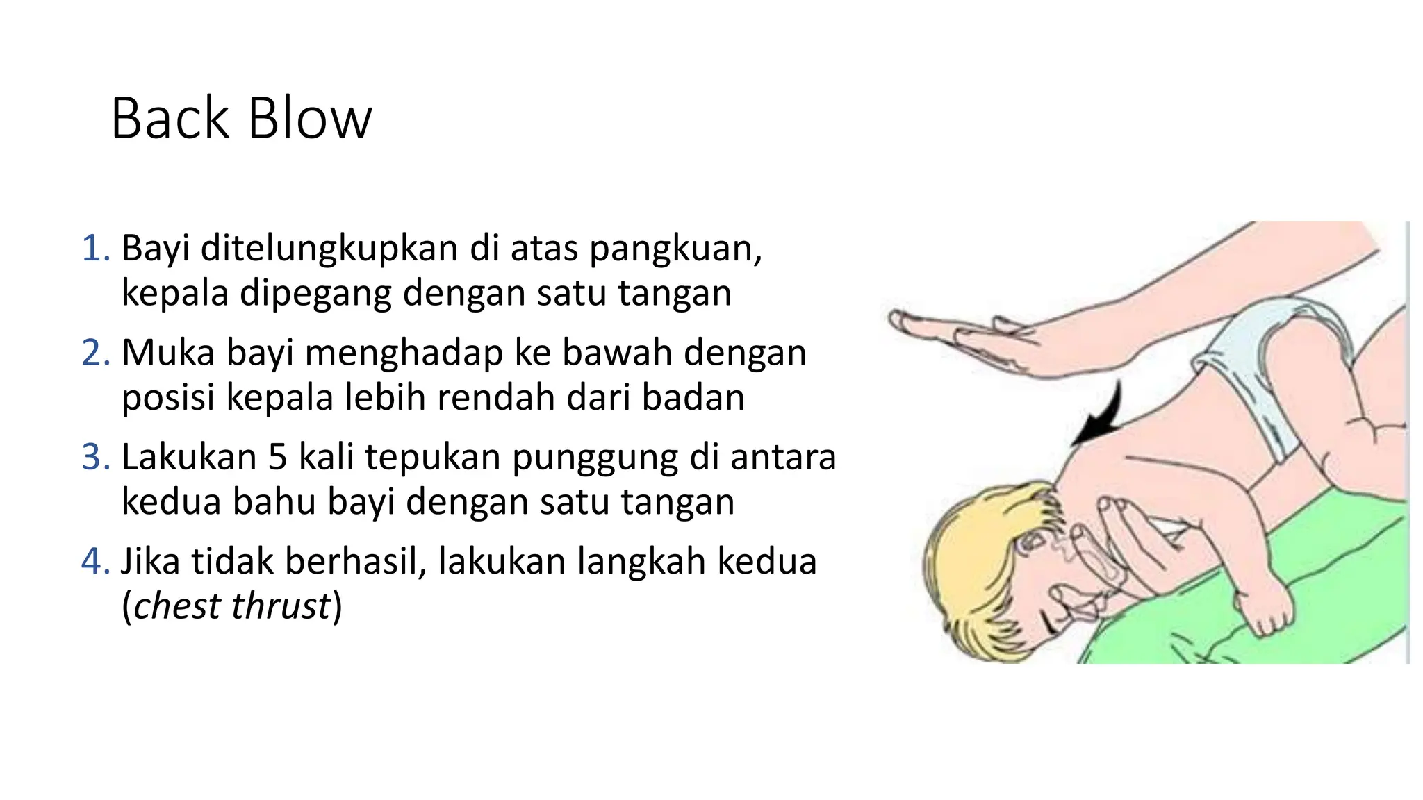 PENANGANAN AWAL TERSEDAK pasien mau ma.pptx