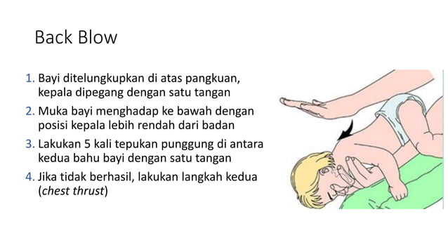 PENANGANAN AWAL TERSEDAK pasien mau ma.pptx