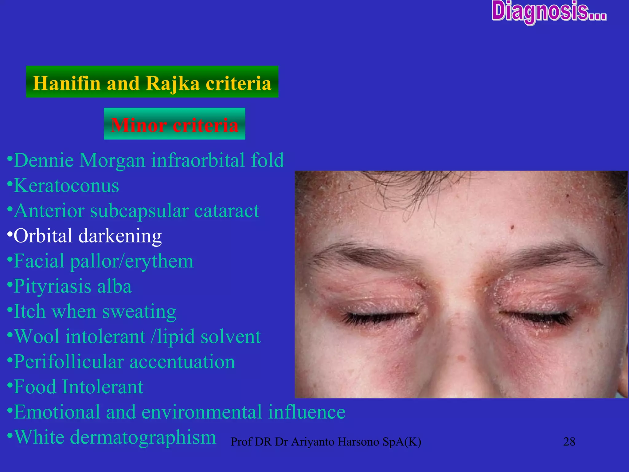 Penanganan Dermatitis Atopik | PPT