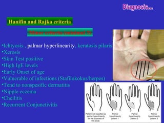 Penanganan Dermatitis Atopik | PPT