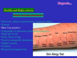 Penanganan Dermatitis Atopik | PPT