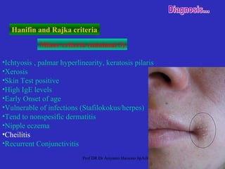 Penanganan Dermatitis Atopik | PPT