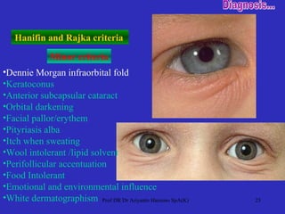 Penanganan Dermatitis Atopik | PPT