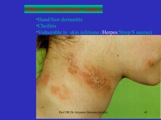 Penanganan Dermatitis Atopik | PPT
