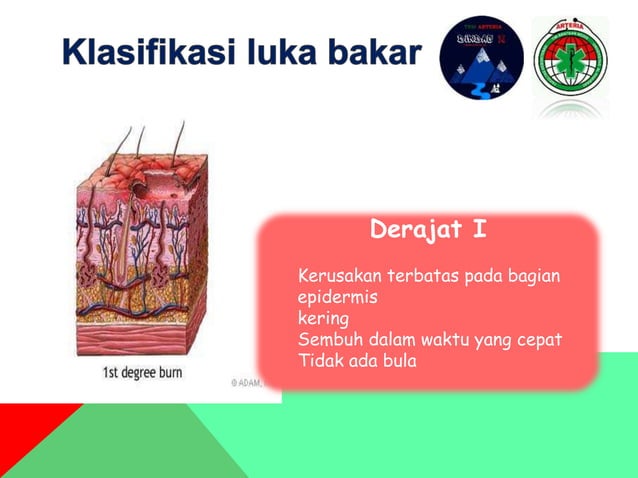 Penanganan Luka Bakar DIKDAS X.pptx
