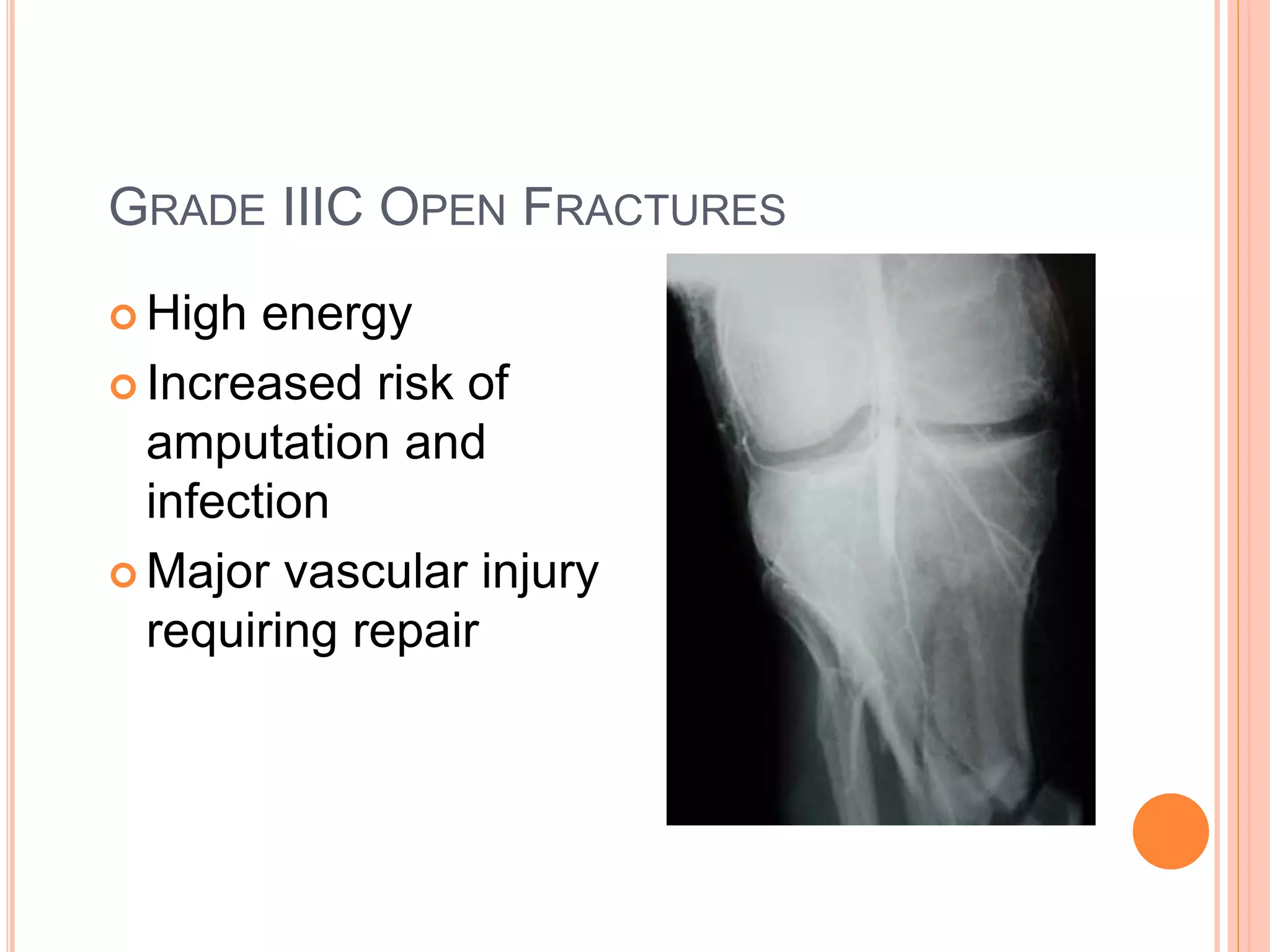 Penanganan terkini patah tulang terbuka (open fracture) | PPTX