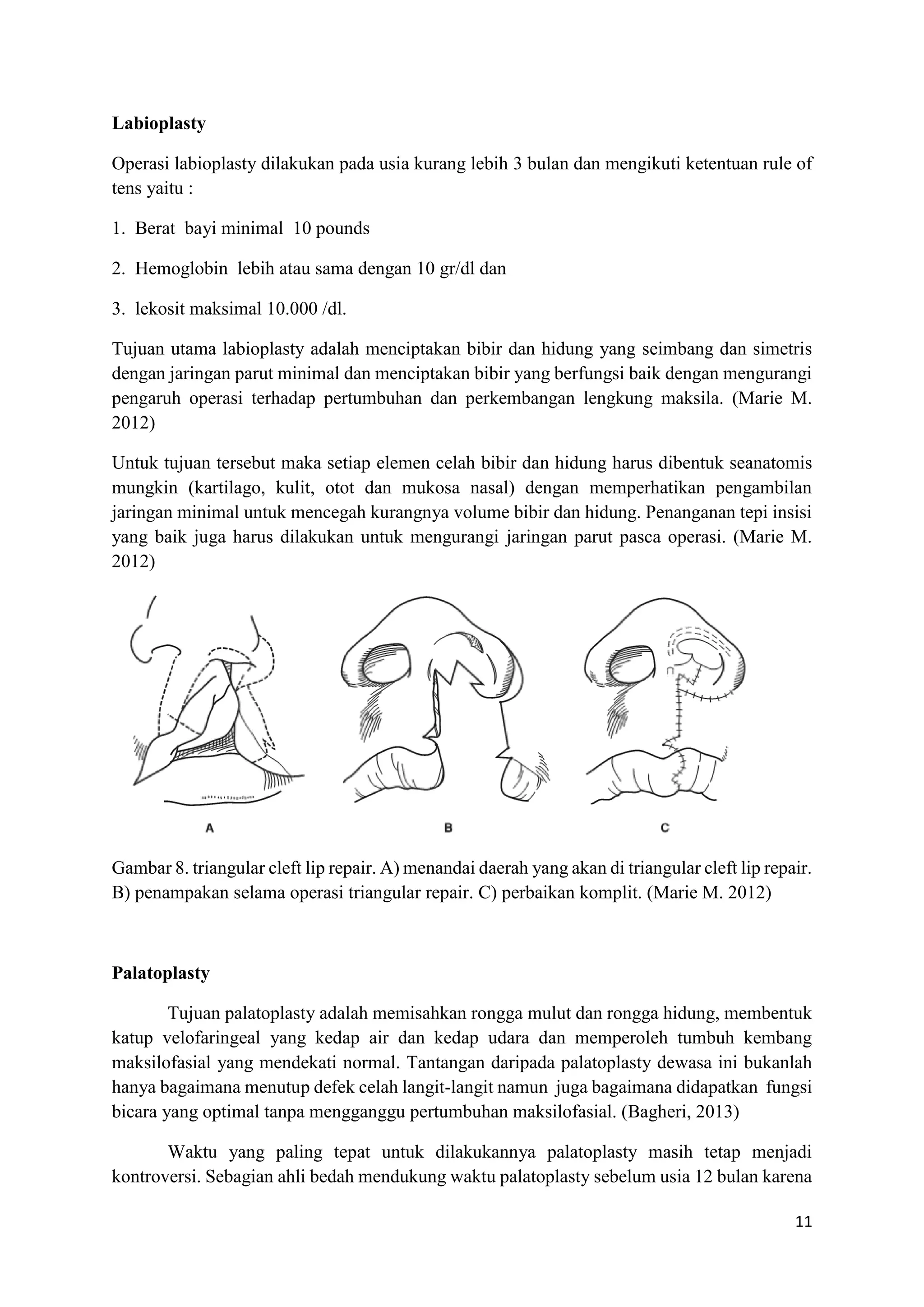 Penatalaksanaan cleft lip palate sumbing aai | PDF